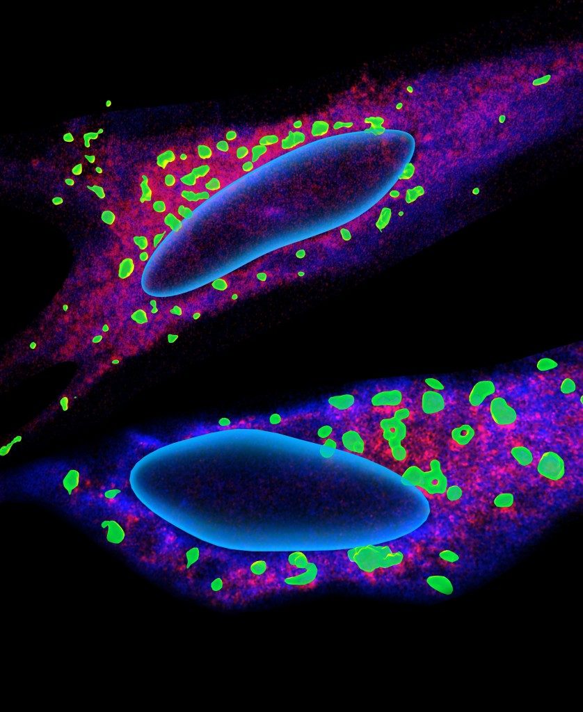 The adaptor-associated kinase 1, AAK1, is a positive regulator of the ...