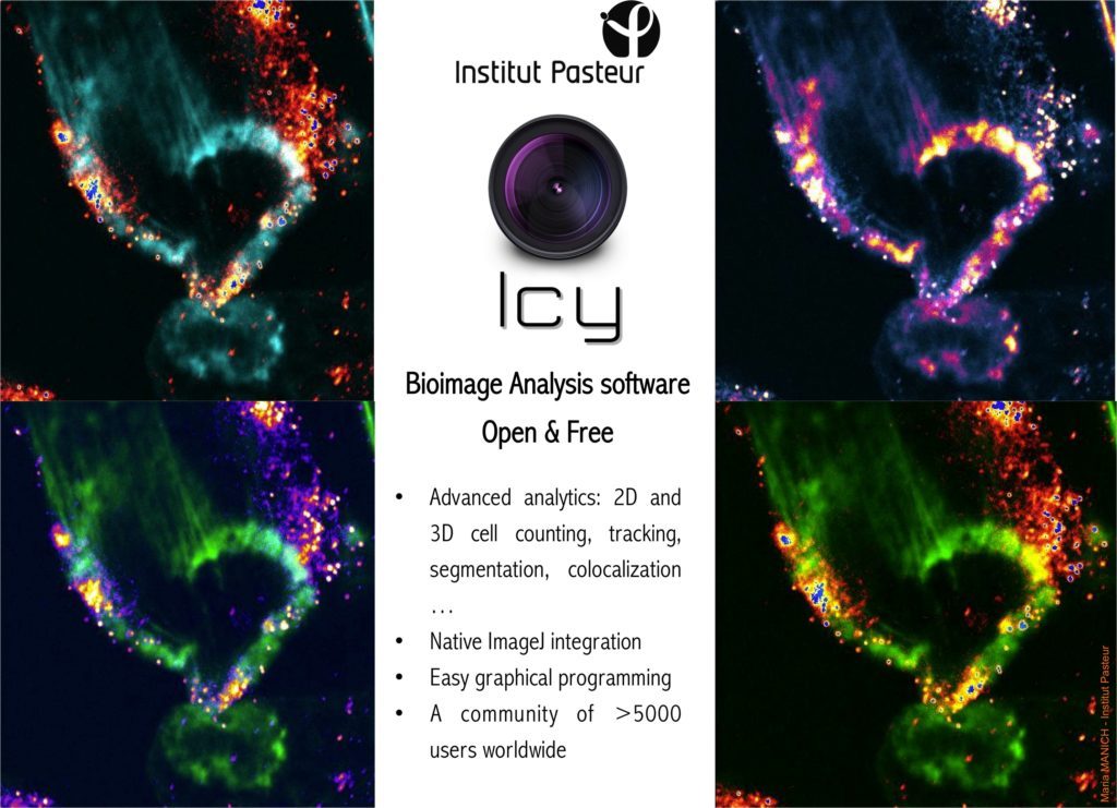 Jean-Christophe Olivo-Marin - Biological Image Analysis - Research ...