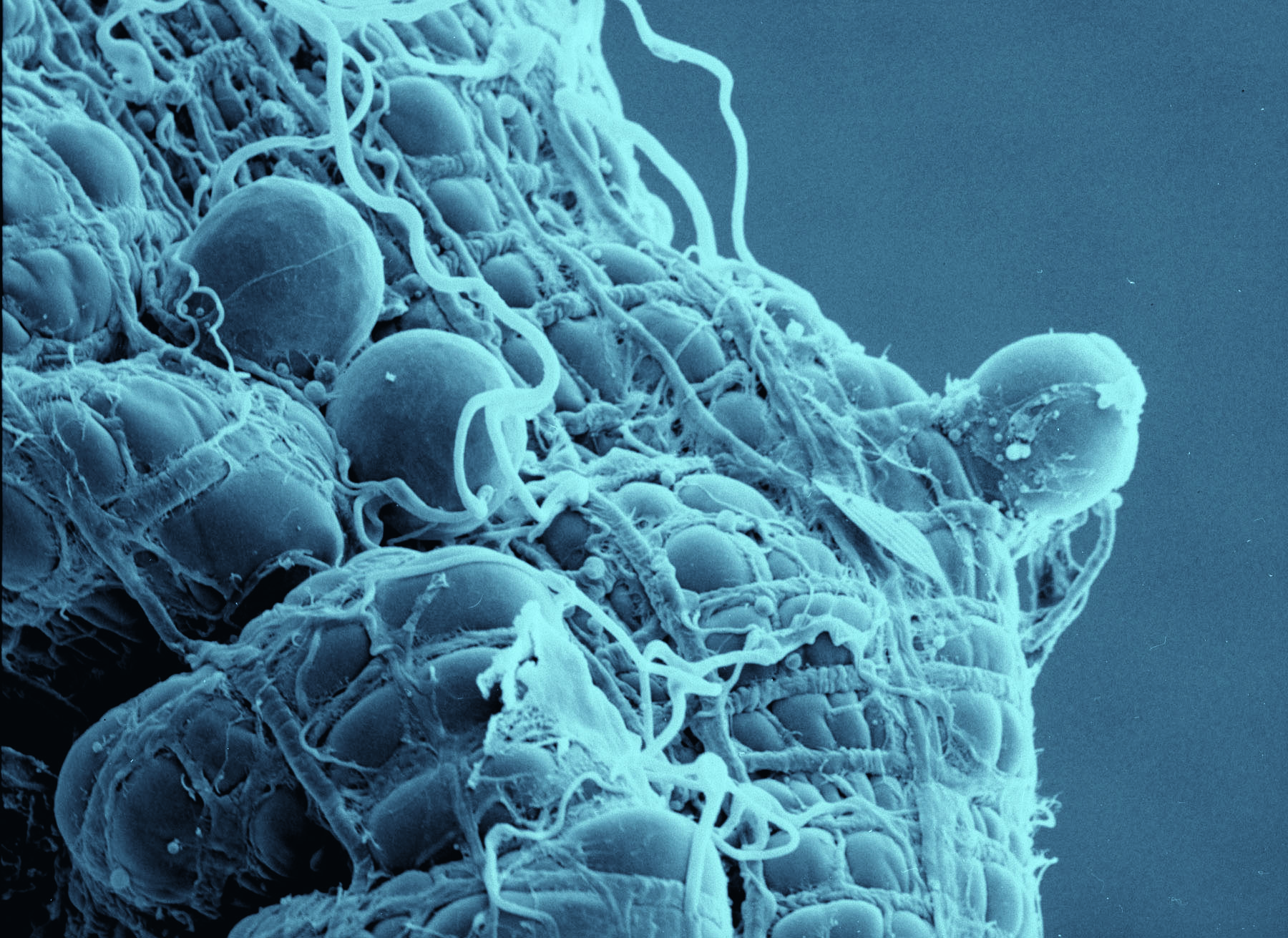 Anavaj Sakuntabhai - Ecology and Emergence of Arthropod-borne Pathogens ...