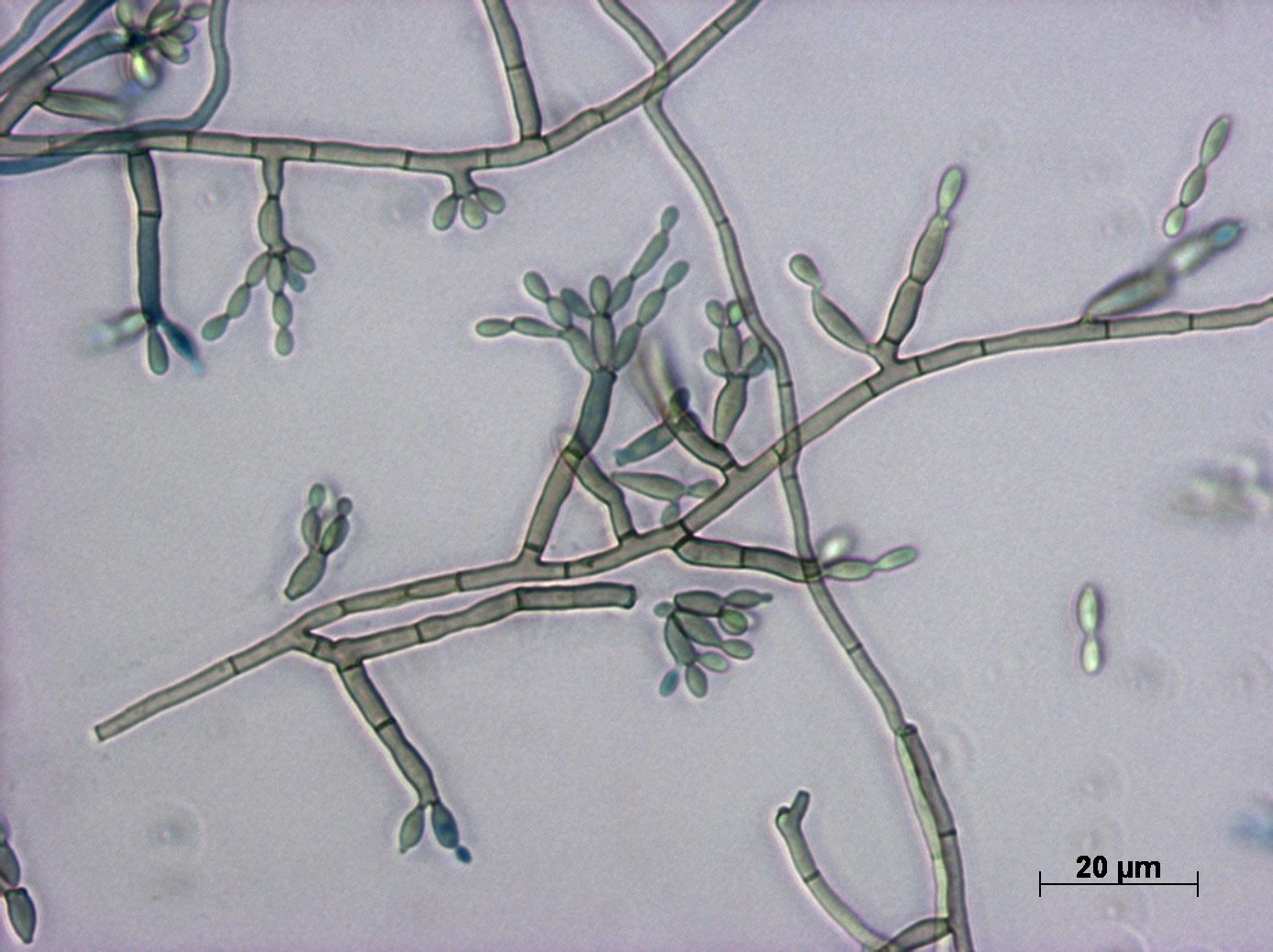 Françoise Dromer - Mycoses Invasives et Antifongiques • Recherche ...