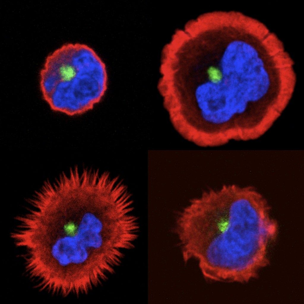 Microscopy Archives - Research - Institut Pasteur