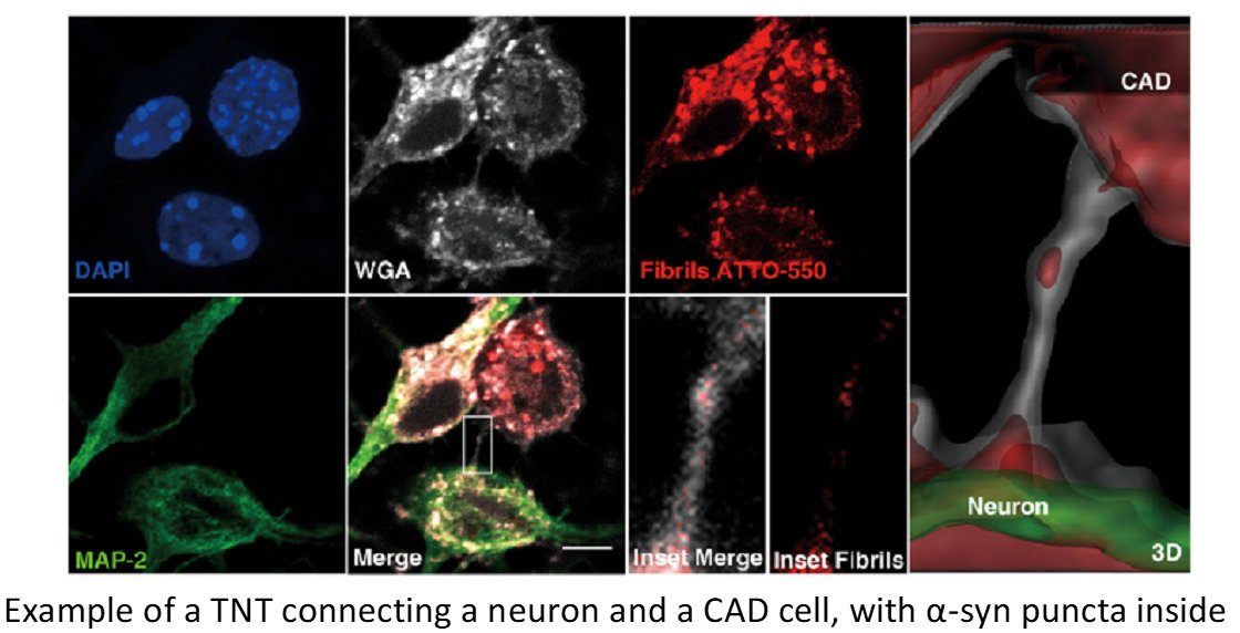 Chiara Zurzolo - Prion-like proteins spreading in neurodegenerative diseases: role of Tunneling ...
