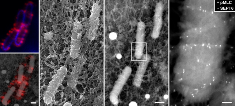 Anna Sartori-Rupp - Correlative Light and Electron Microscopy Node ...