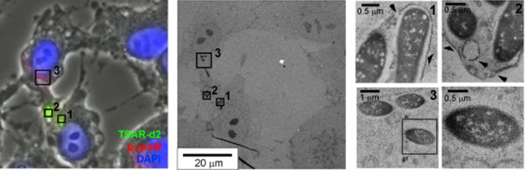 Correlative Light and Electron Microscopy • Research - Institut Pasteur