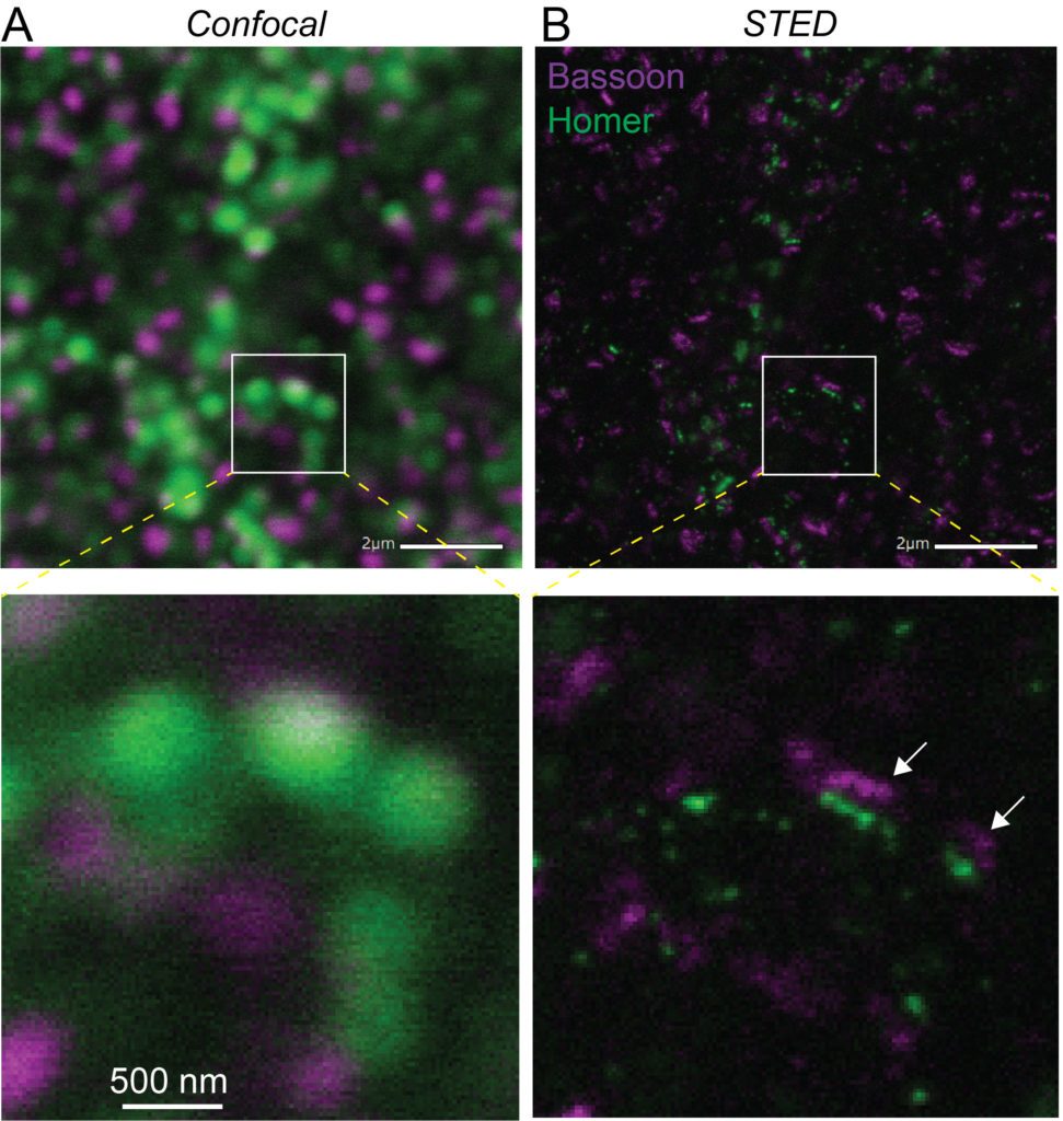 David DiGregorio - Superresolution imaging of the diversity ...