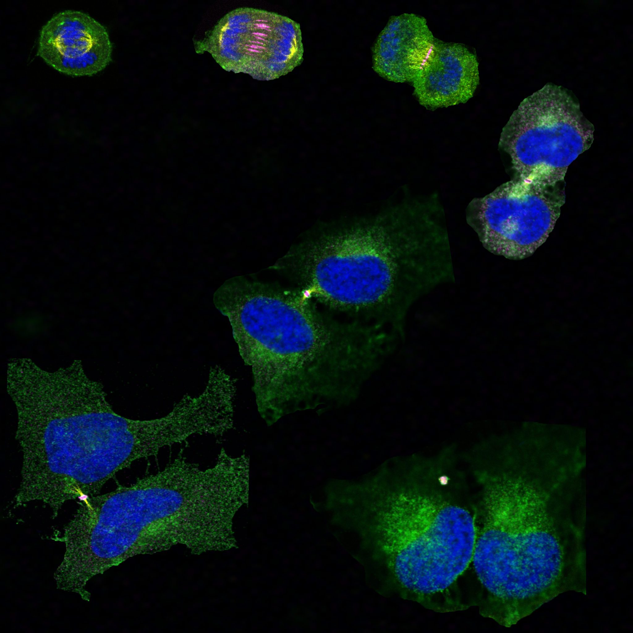 BST2, a common trait between viral infections and midbodies - Research ...