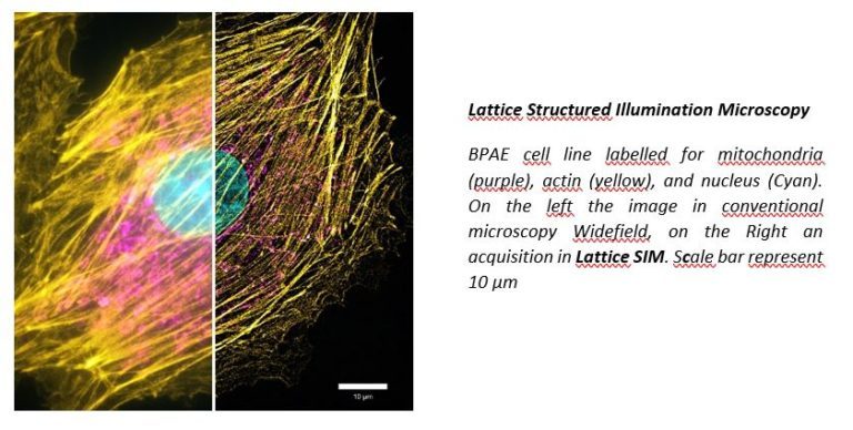 Microscope Super resolution SIM/SMLM - Research - Institut Pasteur