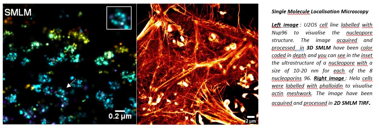 Microscope Super resolution SIM/SMLM - Research - Institut Pasteur