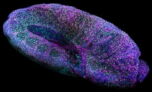 Microscope spinning disk - Research - Institut Pasteur