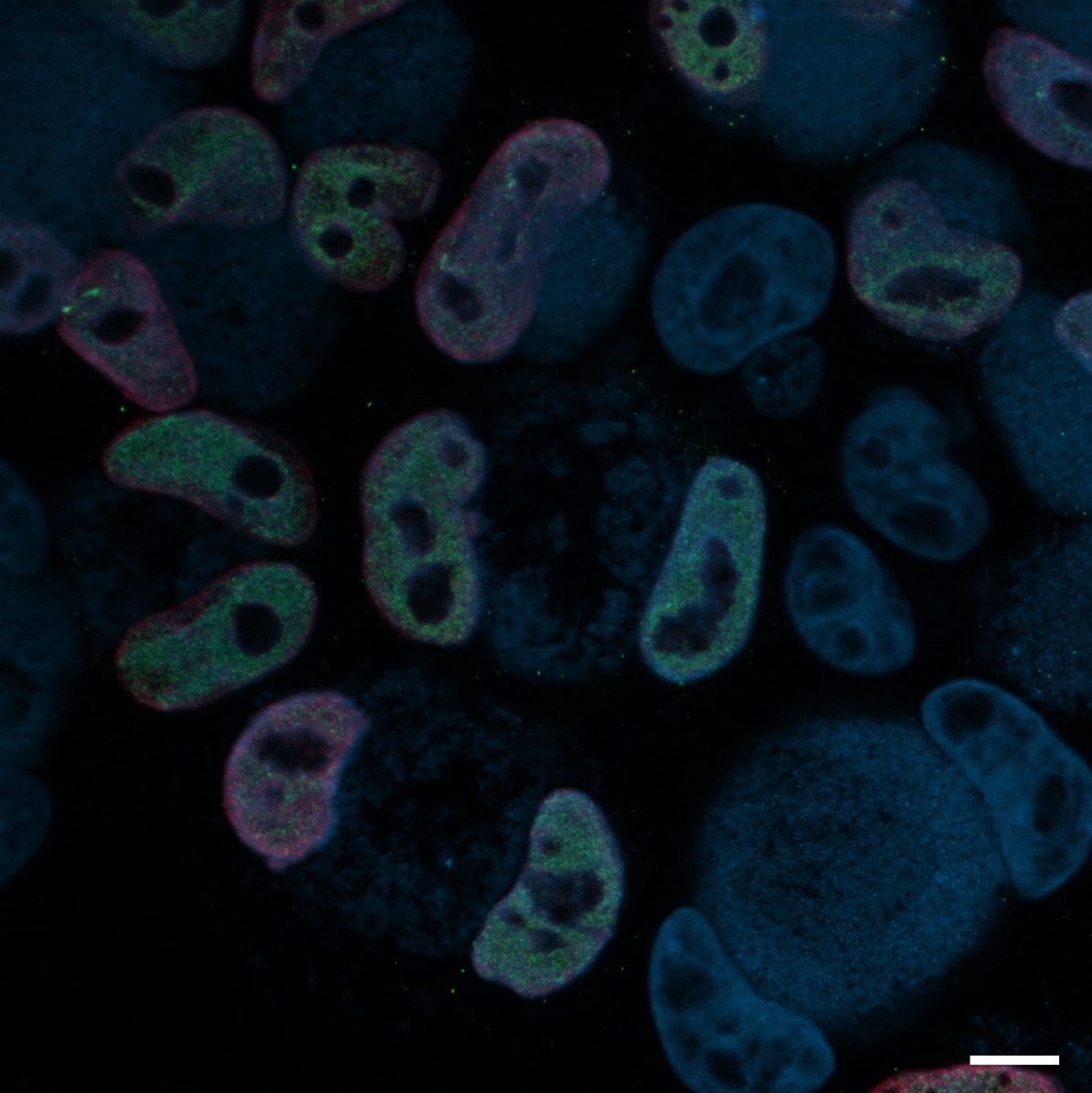 Agathe Subtil - DNA damage during Chlamydia infection - Research ...