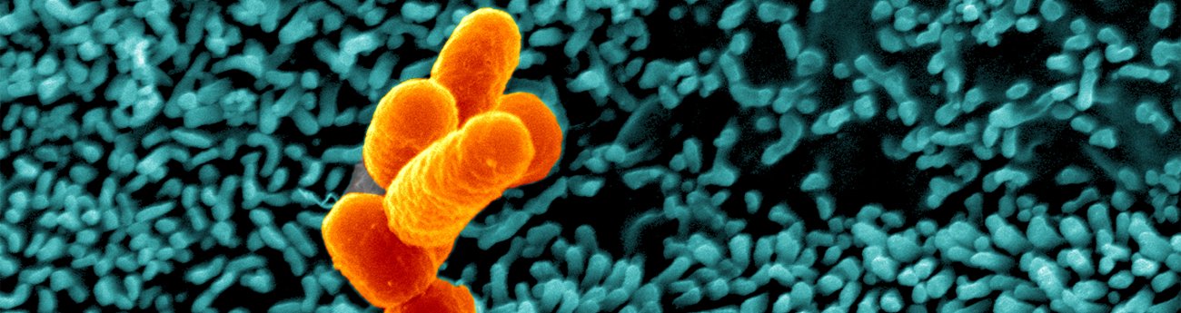 GenEpi-BioTrain - Virtual training - Focus on the Agents of Whooping ...